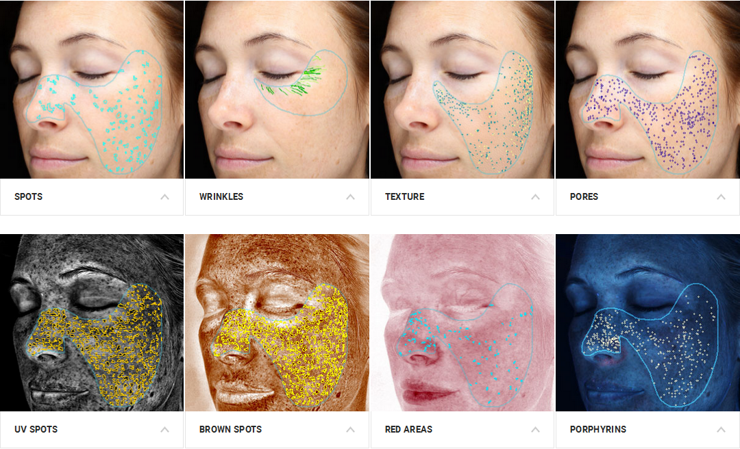 Análisis Facial Visia® - Lidia Pérez dermatólogos